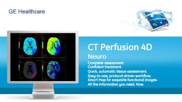 CT Perfusion 4D Neuro | GE Healthcare (Malaysia)