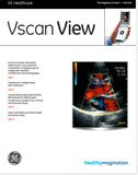 Vscan Pocket-Sized Ultrasound | GE HealthCare (Malaysia)