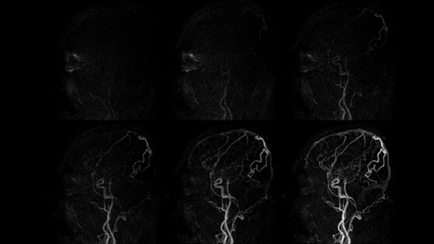 Neuro Imaging | GE Healthcare (Malaysia)