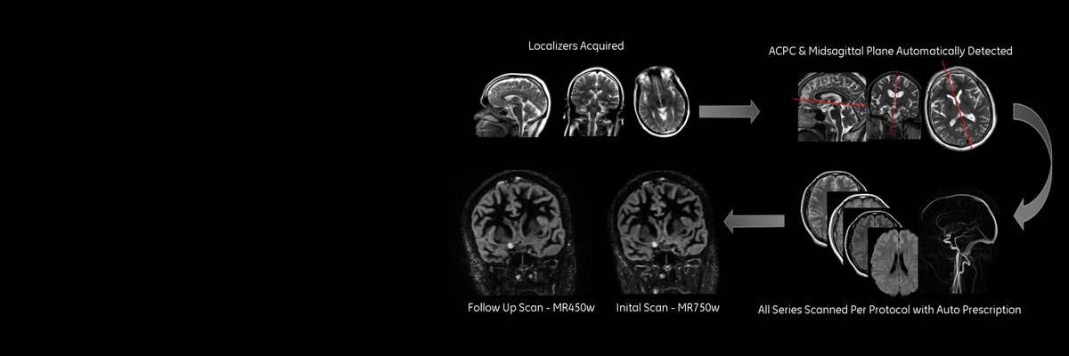Neuro Imaging | GE Healthcare (Malaysia)