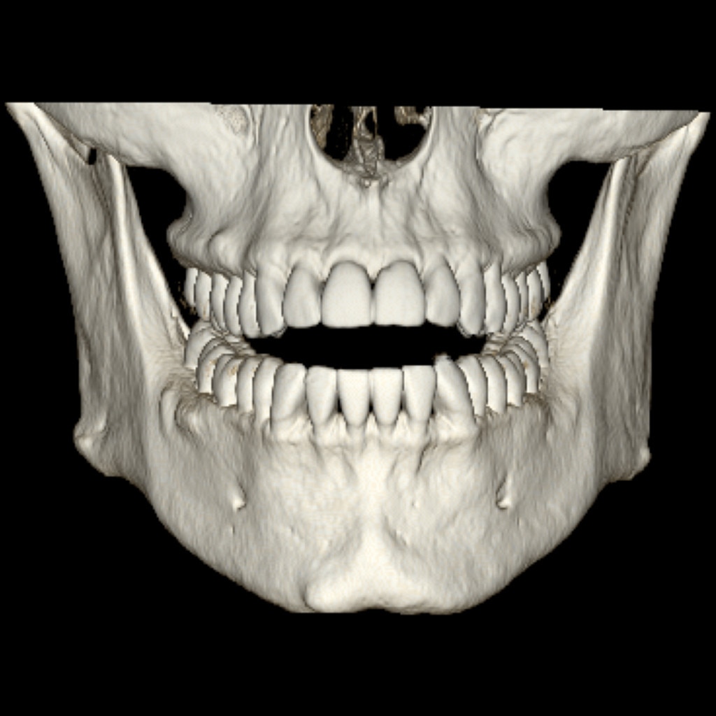 DentaScan | GE HealthCare (Malaysia)