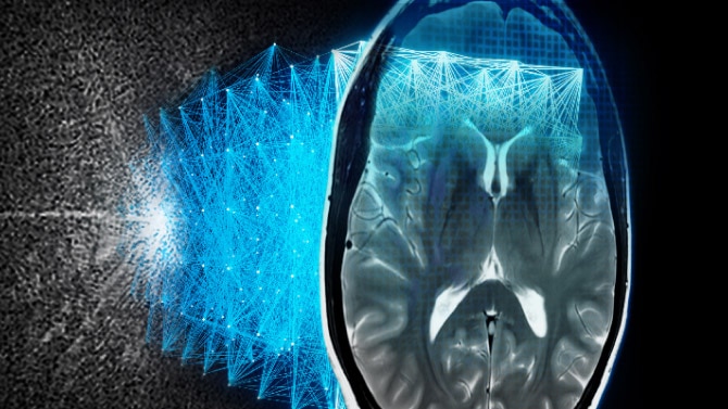 GE Healthcare Systems | GE Healthcare (Philippines)