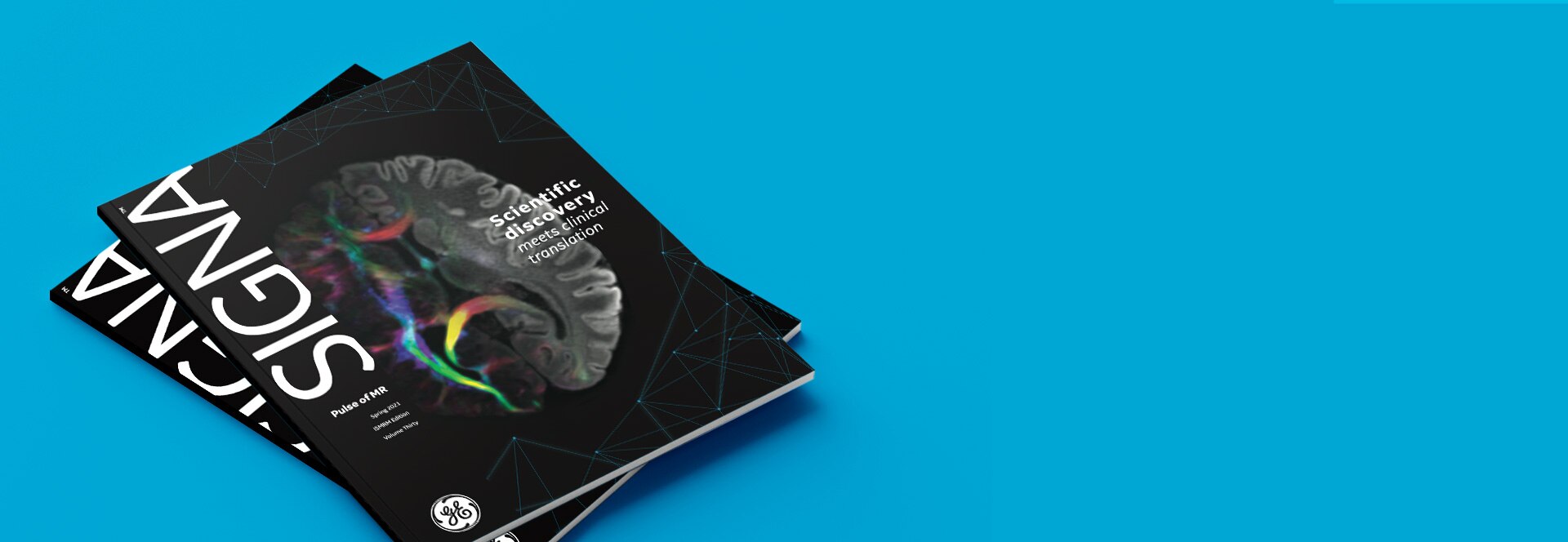 Magnetic Resonance Imaging | GE Healthcare | GE HealthCare (Philippines)