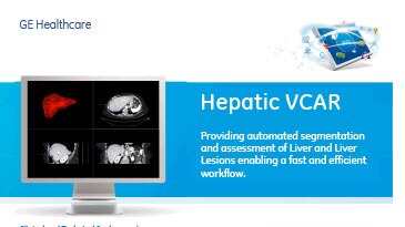 Hepatic VCAR | GE HealthCare (Philippines)