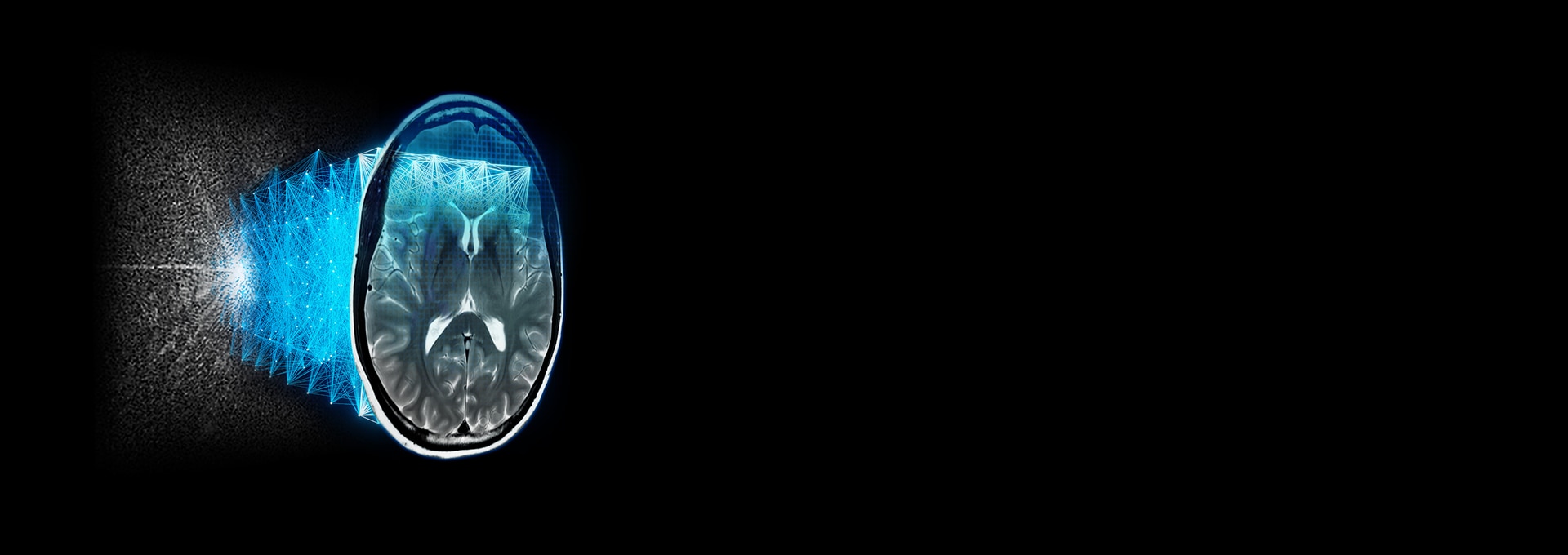 Magnetic Resonance Imaging | GE Healthcare | GE HealthCare (Philippines)