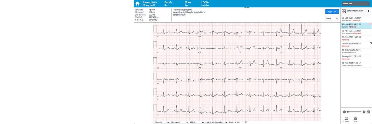 ECG Management | GE HealthCare (Philippines)