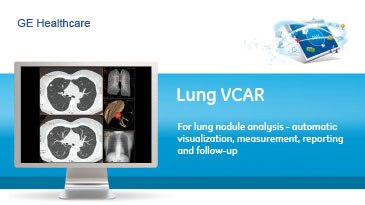 Lung VCAR | GE HealthCare (Philippines)