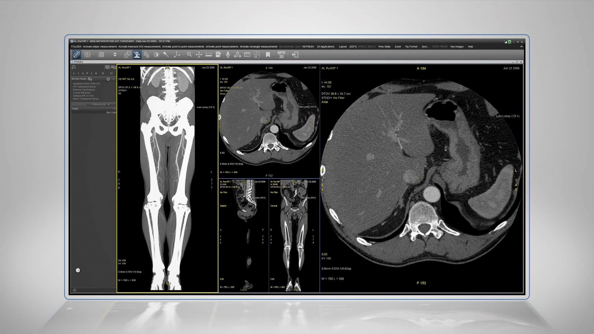 Demo-UniversalViewer-AdvancedVisualization - Centricity Universal ...