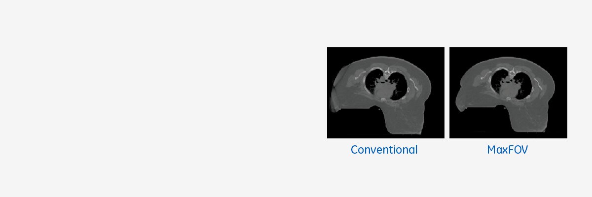 Max Field | GE HealthCare (Philippines)