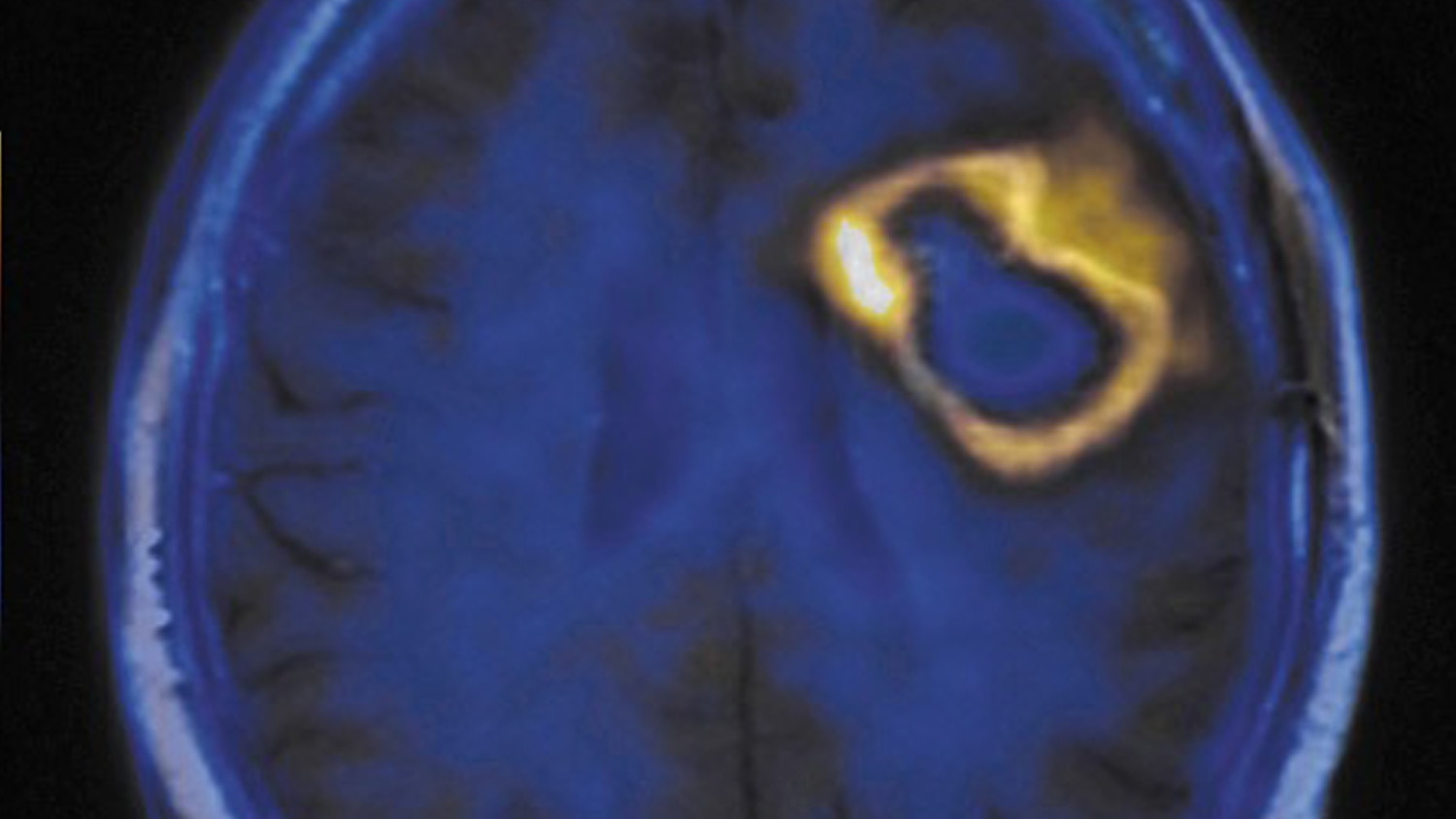 Vascular Advanced Visualization | GE HealthCare (Philippines)