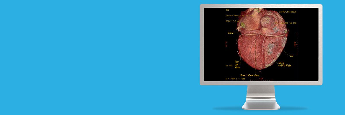 CardEP | GE Healthcare (Philippines)