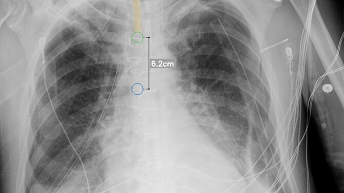 AMX™ Navigate | GE Healthcare (Singapore)