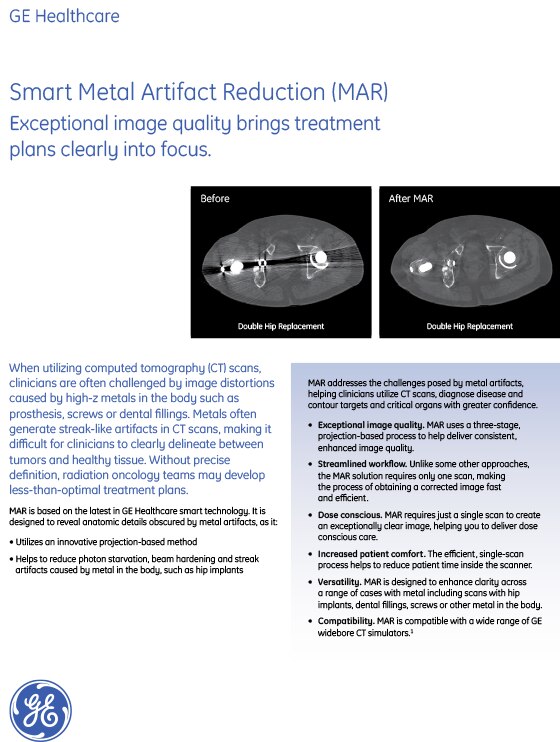Radiation Therapy Planning | GE Healthcare (Singapore)
