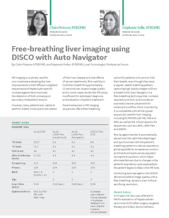 SIGNA Artist AIR Edition | GE Healthcare (Singapore)