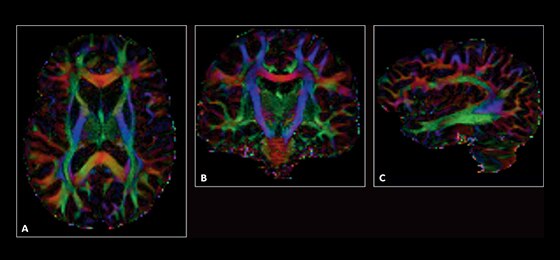 SIGNA™ Premier AIR™ Edition | GE Healthcare (Singapore)