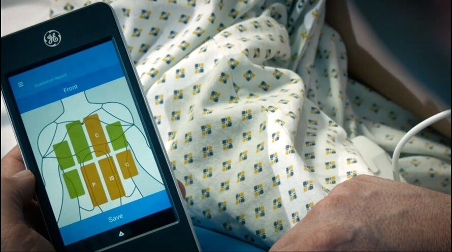 Vscan Extend Portable Ultrasound | GE Healthcare (Singapore)