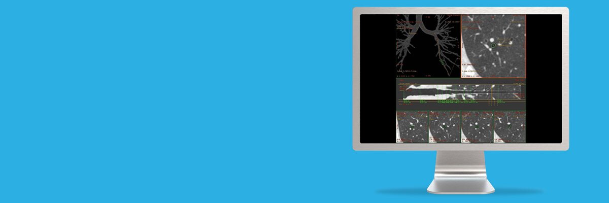 Thoracic VCAR | GE Healthcare (Singapore)