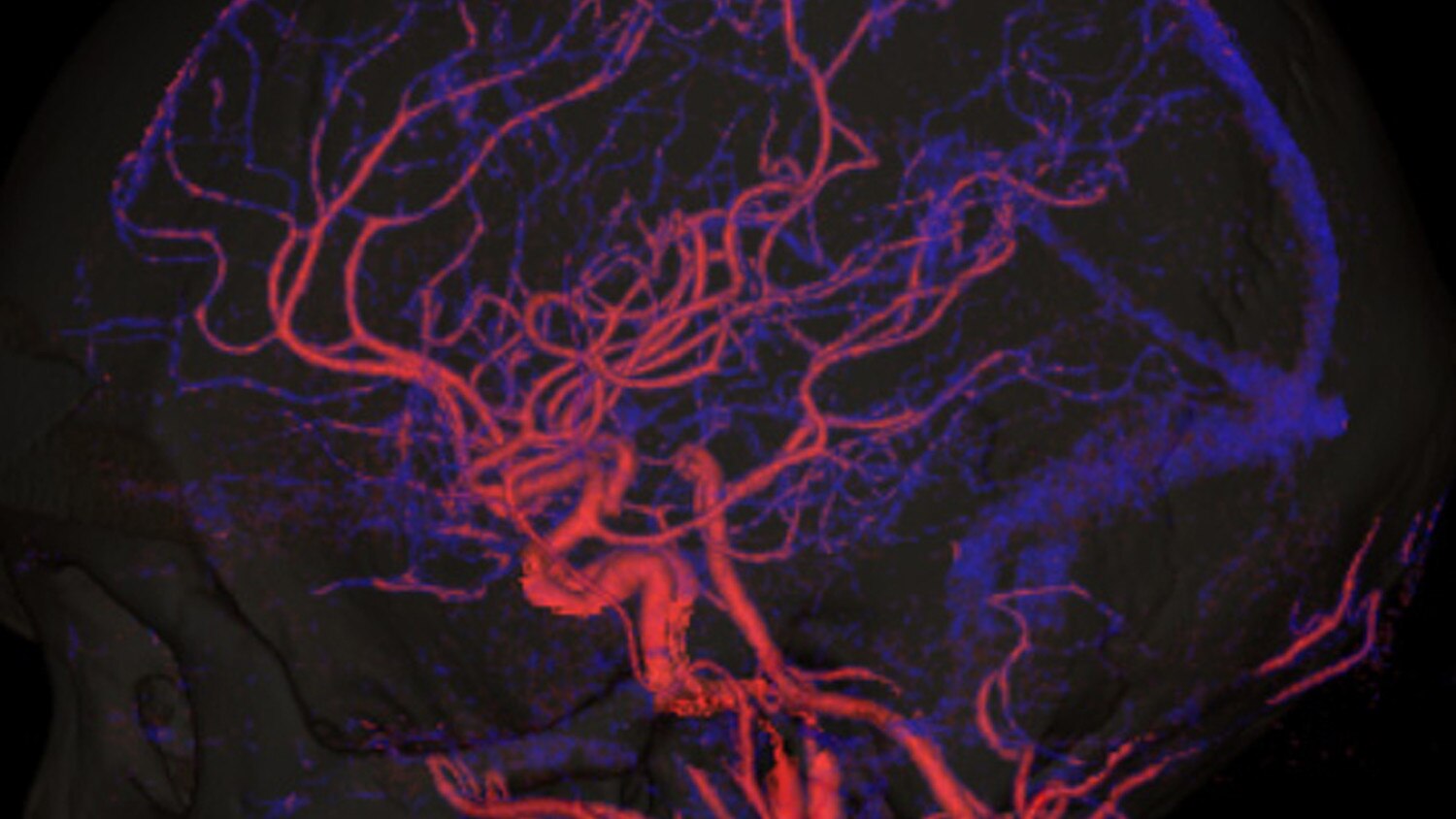 Vascular Advanced Visualization | GE Healthcare (Singapore)