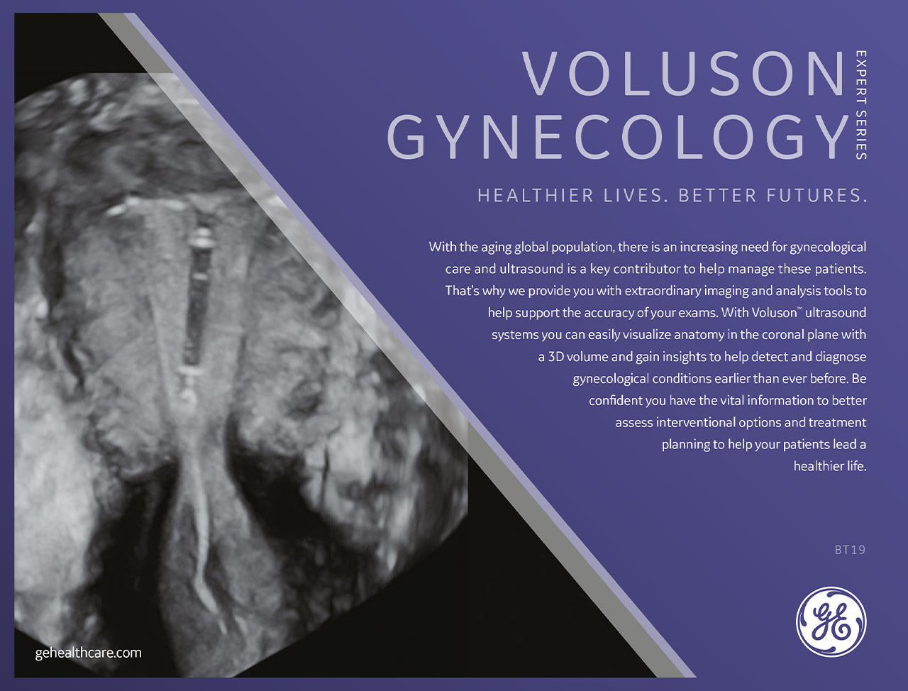 Women’s Health | GE HealthCare (Thailand)