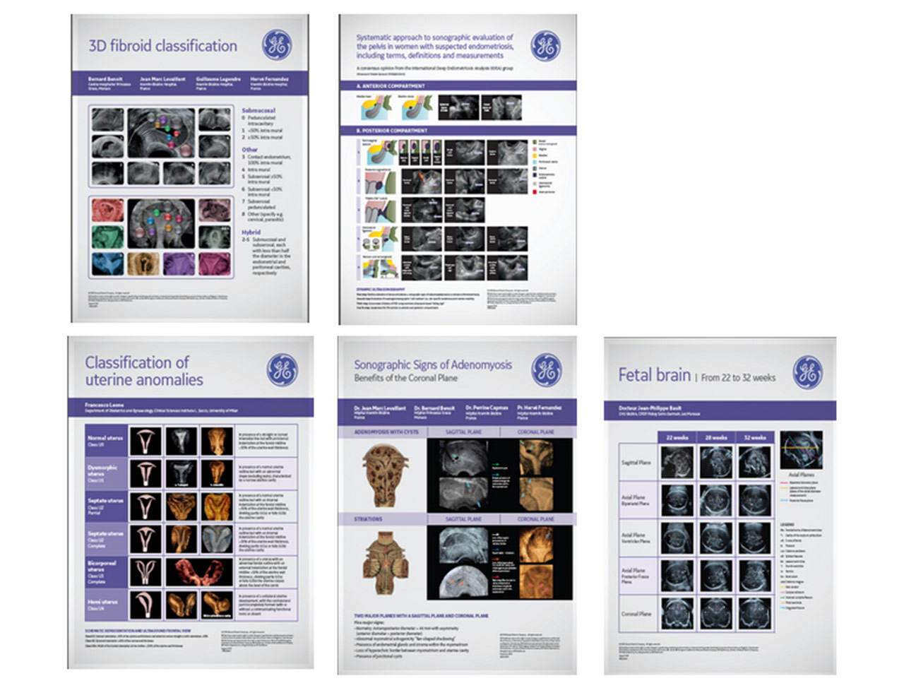 Women’s Health | GE HealthCare (Thailand)