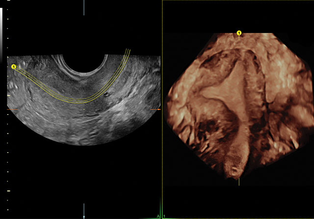 Women’s Health | GE HealthCare (Thailand)