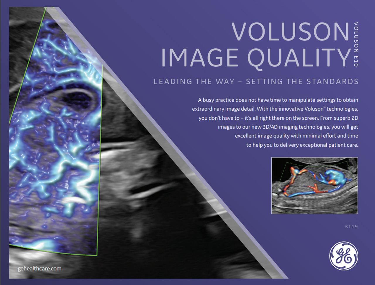 Women’s Health | GE HealthCare (Thailand)