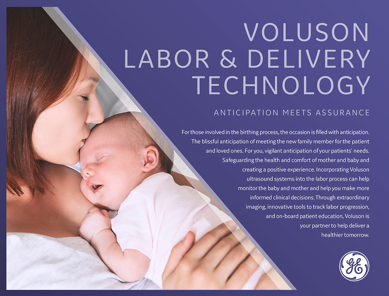 Women’s Health | GE HealthCare (Thailand)