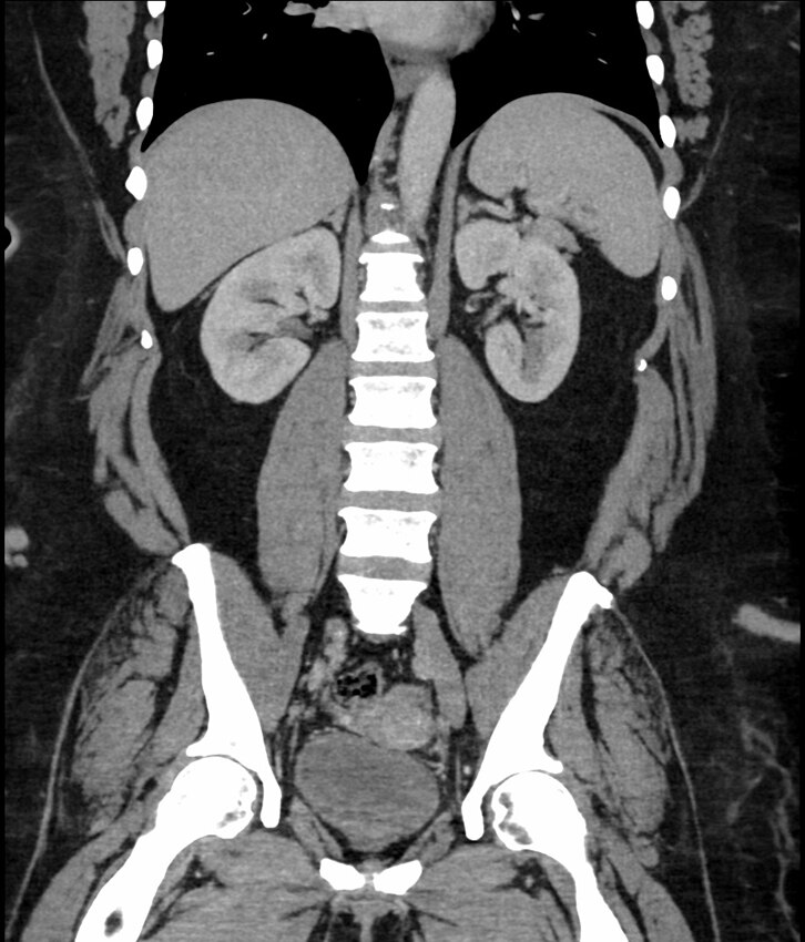 Revolution Apex | GE HealthCare (Thailand)