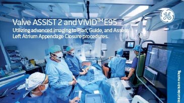 Innova IGS 530 for Cardiology | GE HealthCare (Thailand)