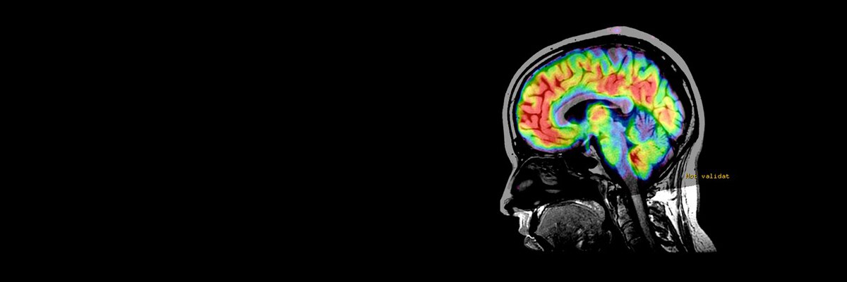 Neuro Imaging | GE HealthCare (Thailand)