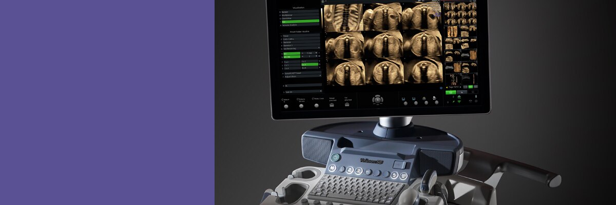2D, 3D and 4D Ultrasound | Voluson S8 | Voluson Signature Series | GE ...