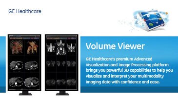 Volume Viewer | GE HealthCare (Thailand)