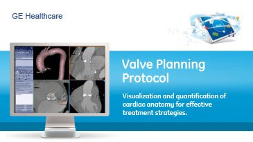 Valve Planning Protocol | GE HealthCare (Thailand)