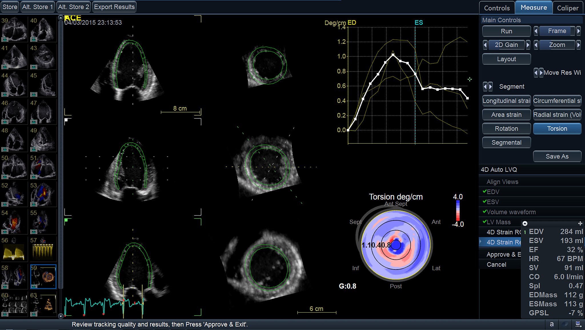 ViewPoint 6 and EchoPAC Suite for Cardiology | GE HealthCare (Thailand)