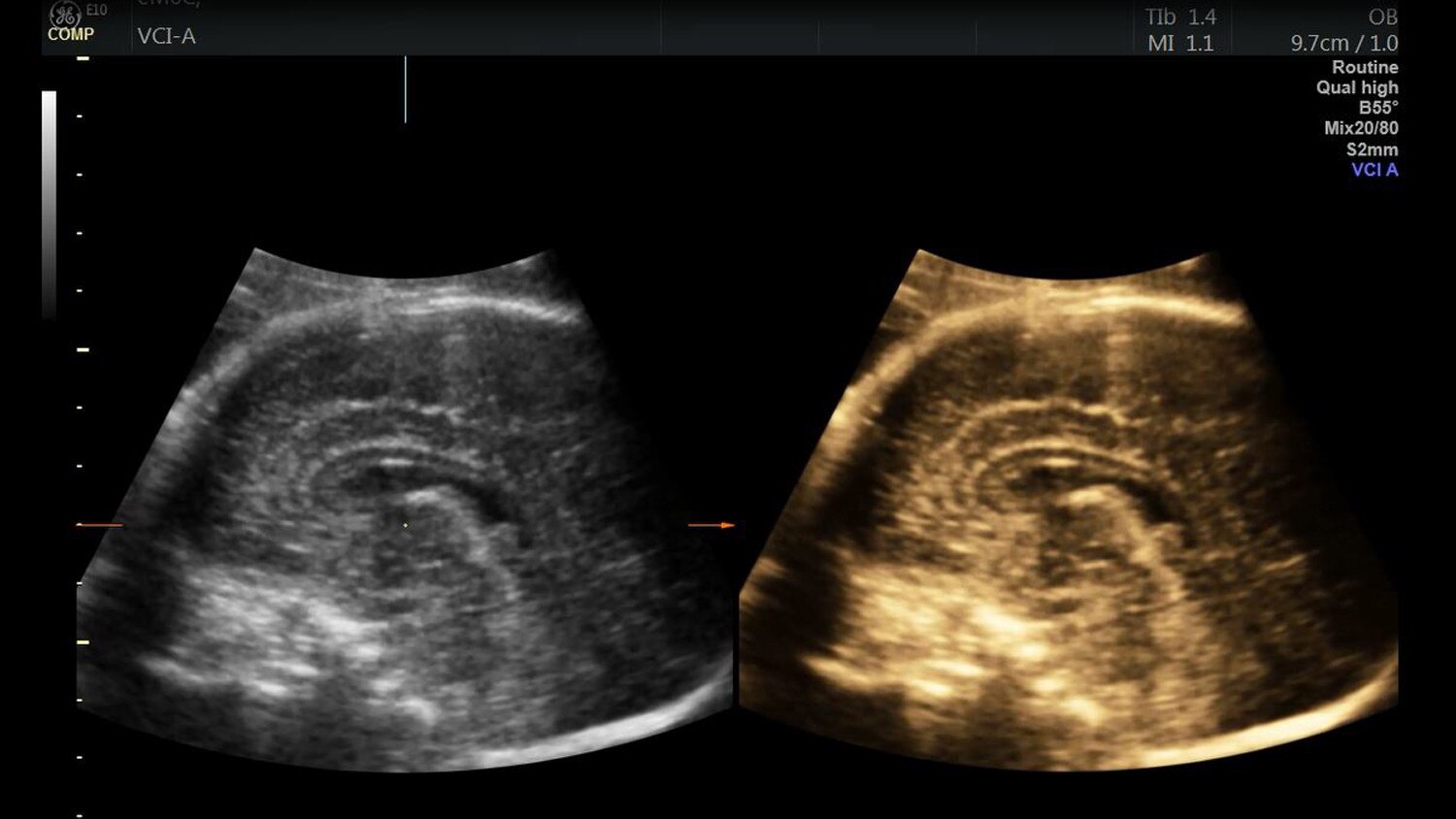 Advanced Probe Technologies - Voluson E10 - Voluson - Ultrasound ...