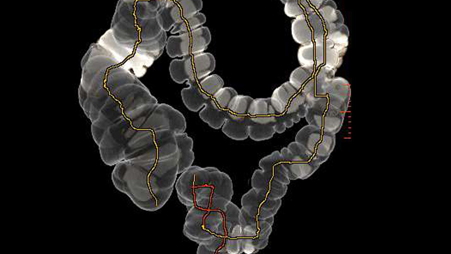 CT Advanced Visualization | GE Healthcare (Thailand)