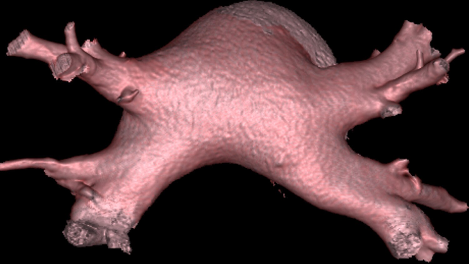 Cardiology Advanced Visualization | GE HealthCare (Thailand)