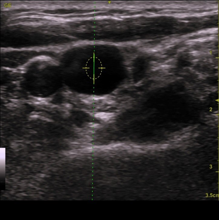 Anesthesiology - Venue 50 - Point of Care Ultrasound - Ultrasound ...