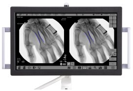 OEC MiniView | GE HealthCare (Middle East)