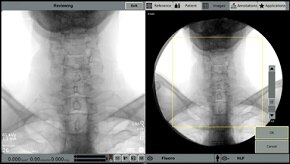 OEC Elite | GE HealthCare (Middle East)