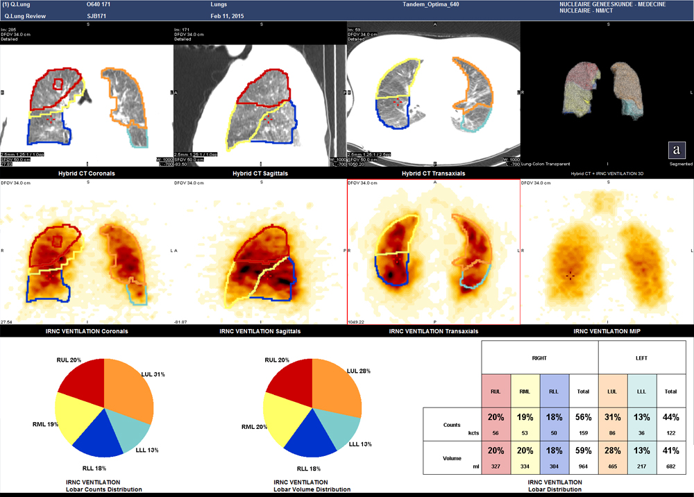 NM/CT 850 | GE Healthcare (United States)