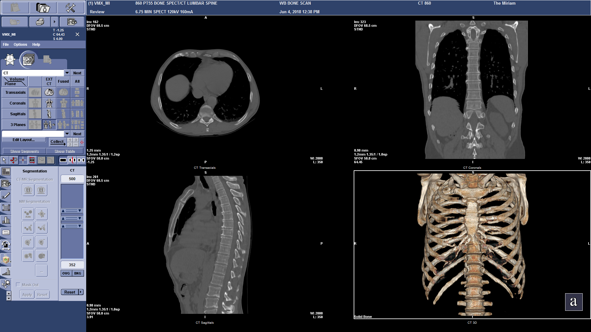 NM/CT 860 | GE Healthcare (United States)