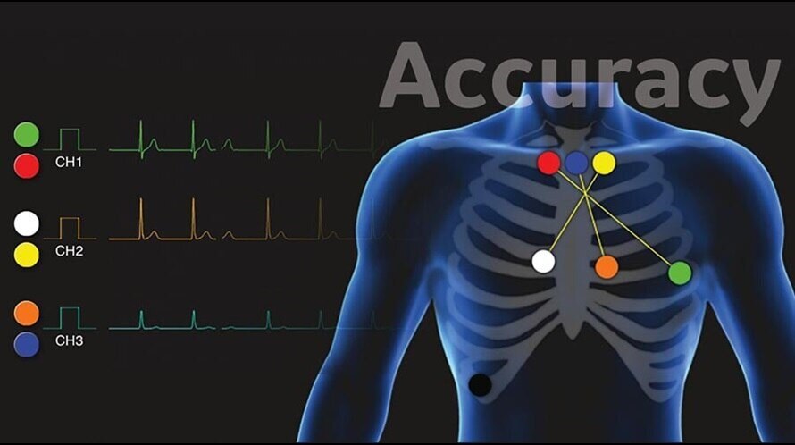 Stroke Solutions | gehealthcare网