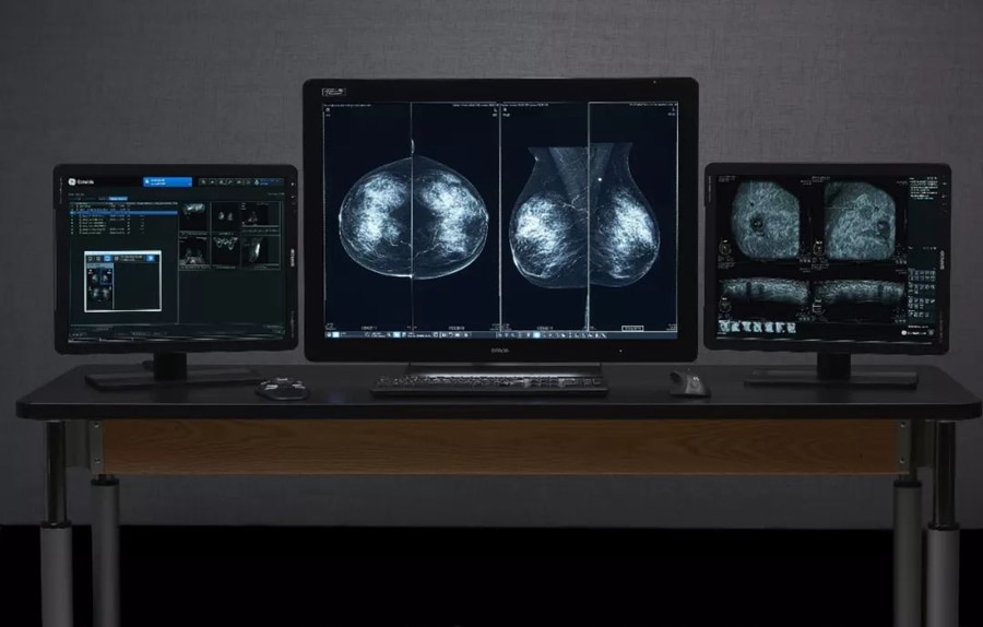 GE医疗发布全新自动乳腺超声诊断系统Invenia™ ABUS 2.0_GE医疗 | gehealthcare网 GE医疗发布全新自动乳腺超声诊断系统Invenia™ ABUS 2.0_GE医疗 | gehealthcare网